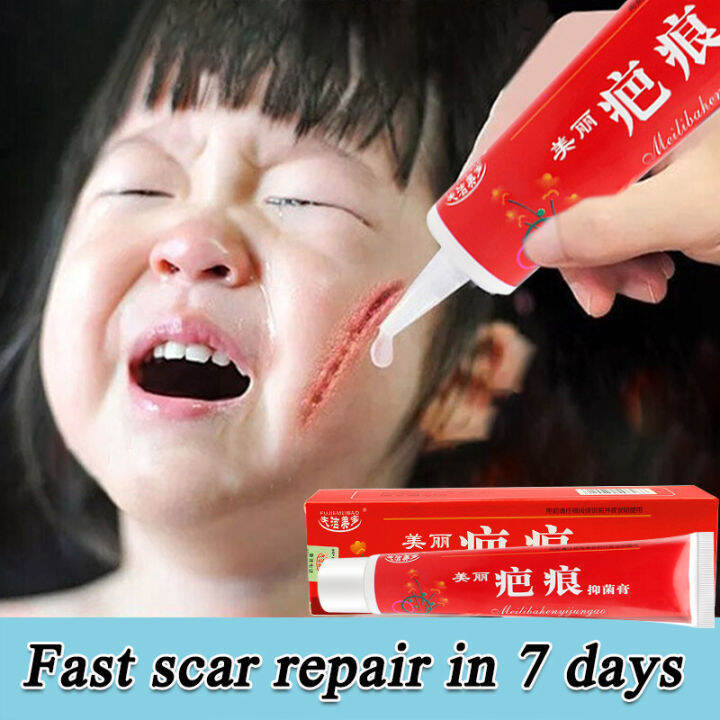 fix scar removal original scar gel by doc willie ong scars remover for ...