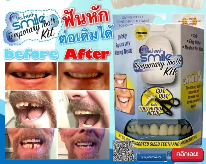 ฟันปลอม ฟันปลอมเสริมบุคลิค Instant smile temporary tooth kit ฟันปลอม ...
