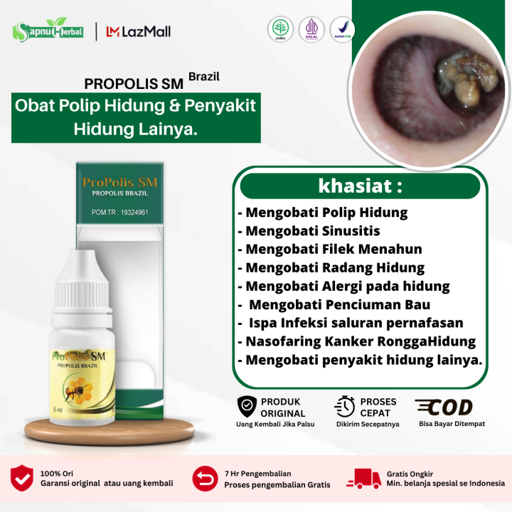 Obat Polip Hidung, Obat Tetes Sinusitis, Benjolan di dalam hidung ...