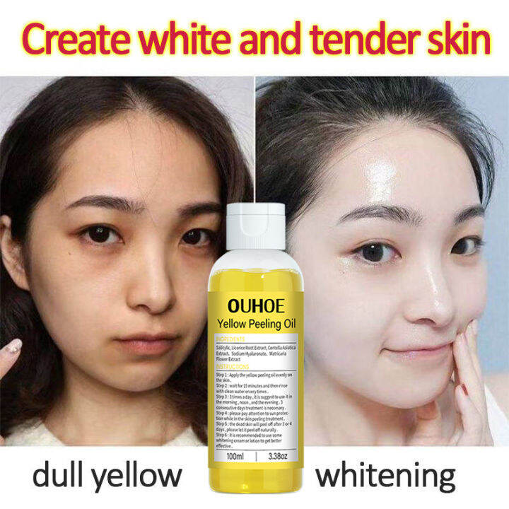 Authentic Yellow Peeling Oil 100ml Reduces skin perfections It ...