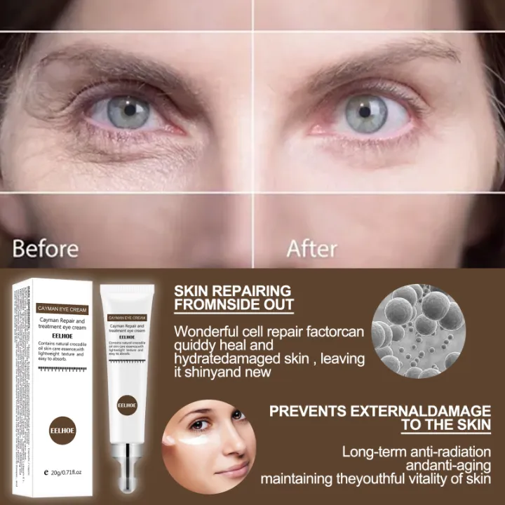 Eelhoe Eye Cream Anti-Puffiness Dark Circle Eye Bag Removal Anti-Aging fades wrinkles Firming ...