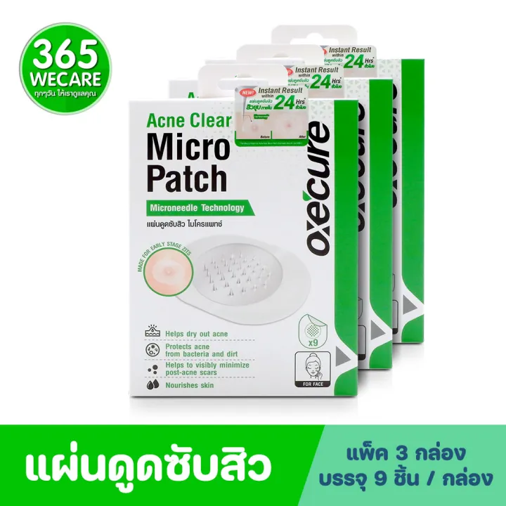 แพ็ค3 กล่อง สุดคุ้ม OXE CURE Acne Clear Micro Patch 9s.(แผ่นดูดซับสิว) 365wecare | Lazada.co.th