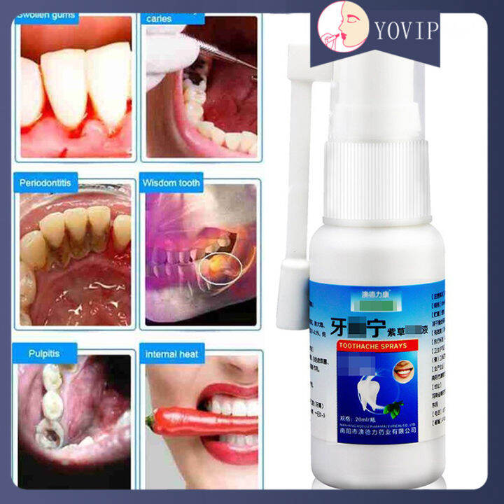 『YOVIP』 Toothache Pain Relief Teeth Care Sprays Effective Dental Tooth ...