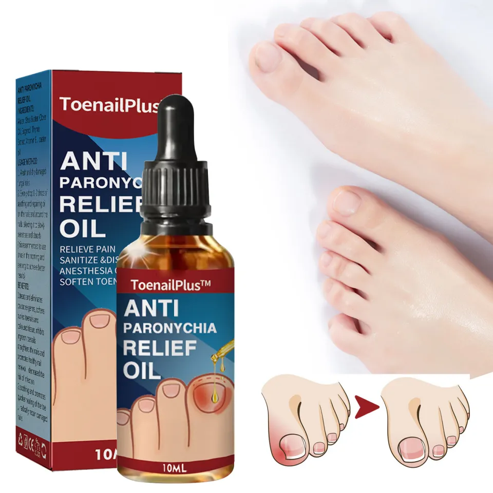 Onychia And Paronychia Of Toe