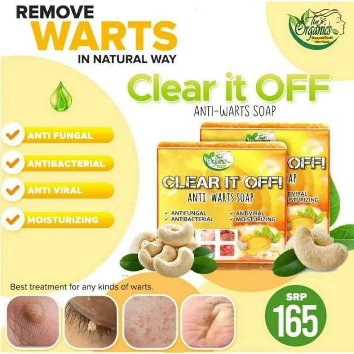 Organic Anti Warts Soap - Clear It Off! by Pretty Tin's Organics/ Warts ...