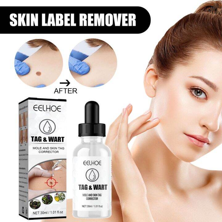 Original Wart Remover Serum Wart Removal Mole removal liquid Warts and ...