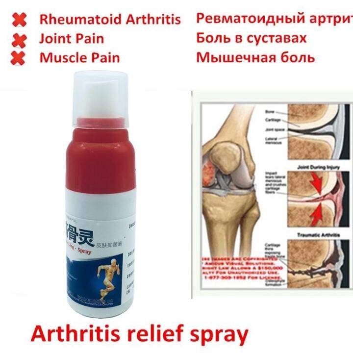 relief pain spray analgesic spray Arthritis spray Penetrates deep into ...