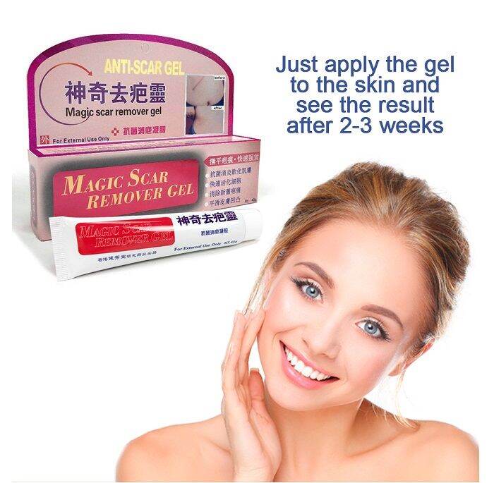 Original Magic Scar ️ Removal Gel keloid Stretchmarks pimple mark ...