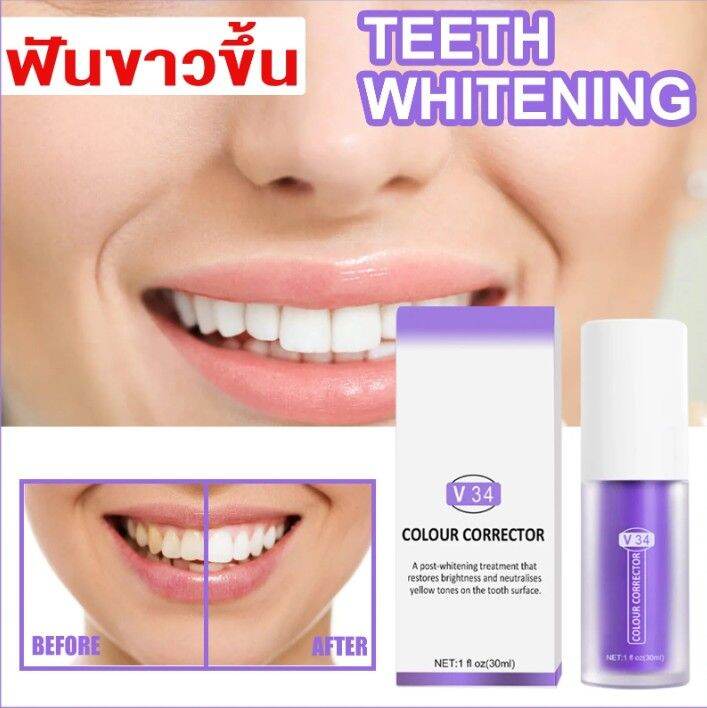 ยาสีฟัน ฟอกฟันขาว เห็นผลทันทีใน 3 วัน [HVIQAN} | Lazada.co.th