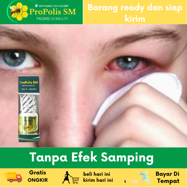 Obat Bintitan Di Kelopak Mata, Obat Mata Bintitan, Obat Benjolan Di ...