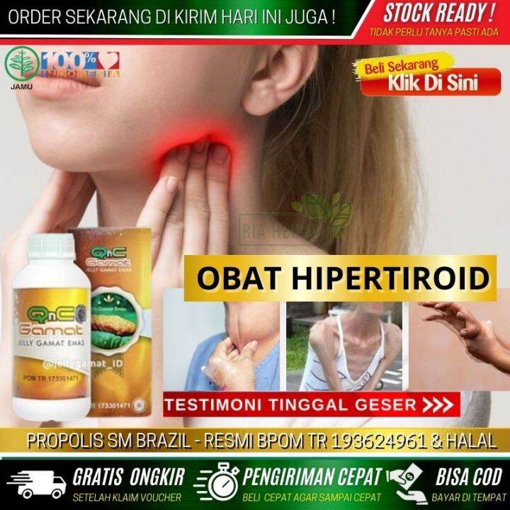 Obat Hipertiroid / Hipertiroidisme Pada Pria dan Wanita, Pembesaran ...