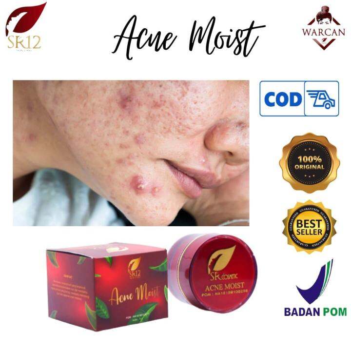 acne moist SR12 | Lazada Indonesia