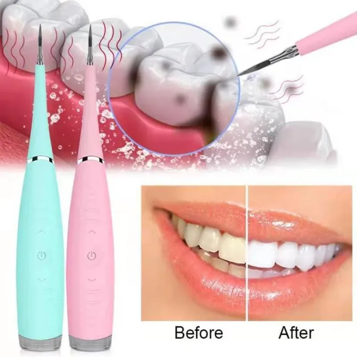 Electric Tooth Cleaner Cleaning Kit Ultrasonic Oral Irrigator Teeth ...