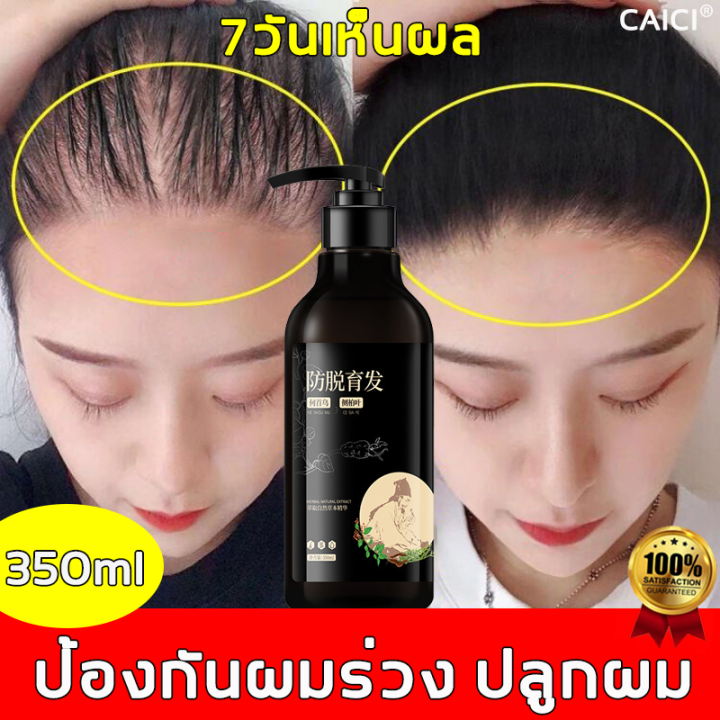 สระผม=ปลูกผม！CAICI แชมพูแก้ผมร่วง 350ml หยุดผมร่วงในหนึ่งวันปลูกผมใน 3 วัน ป้องกันผมร่วง ปลูกผม ...