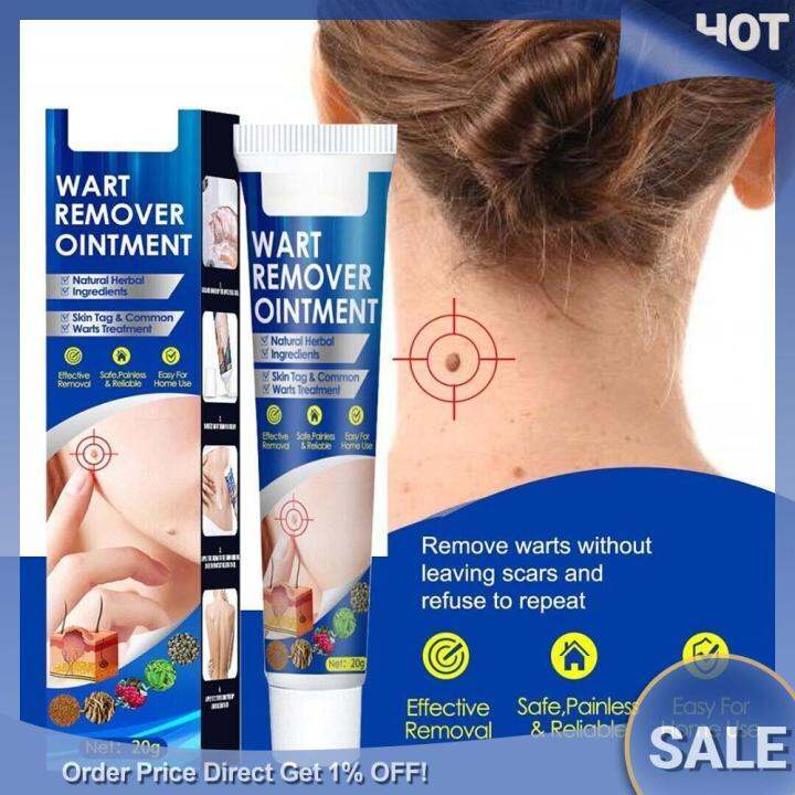Warts Remover Ointment Original Cream 20g Warts Magic Remover Wartz ...