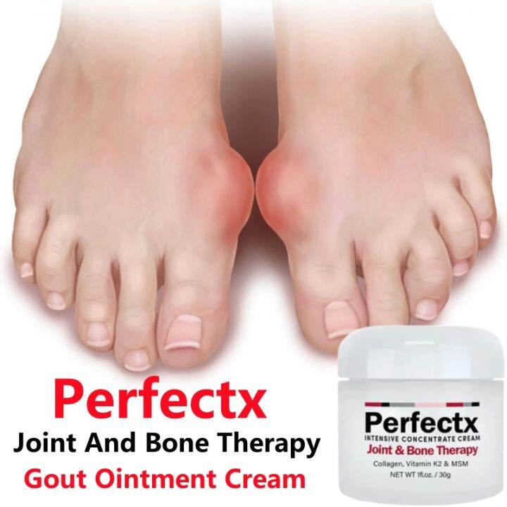 Perfectx joint and bone therapy Cream Treatment Gout Cream Joint Knee ...