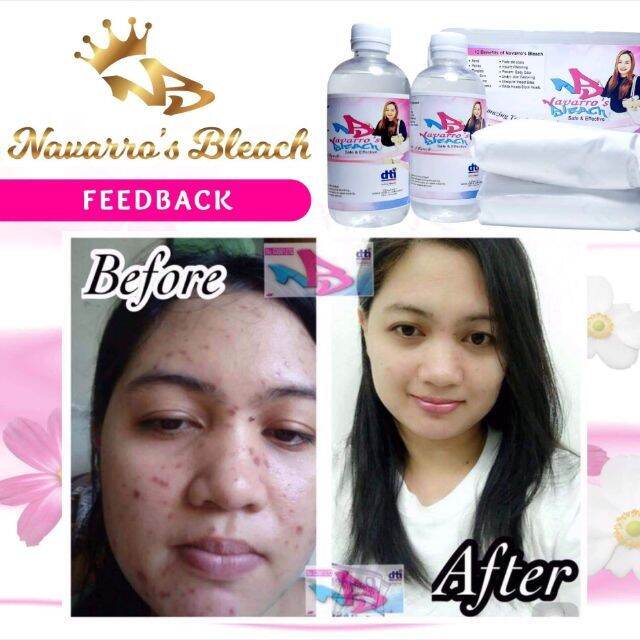 Navarro Bleach Powder mix | Lazada PH