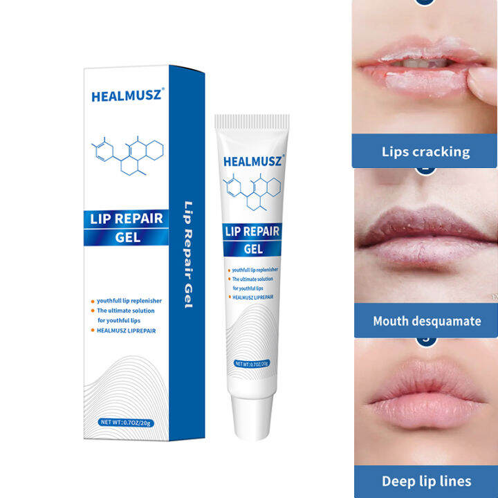 Lip Repair Gel Is Used To Remove Dead Skin Lighten Lip Lines Improve ...