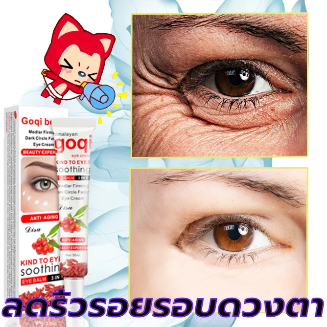 Goqi อายครีม แอนตี้ริงเคิล อายครีม ลดเลือนริ้วรอยรอบดวงตา 30ml ครีมลด ...