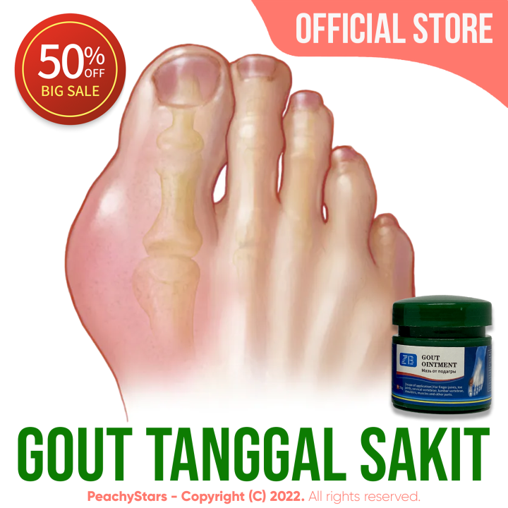 Authentic Gout Ointment Natural Herbal | Gout Pain Reliever | Chinese ...