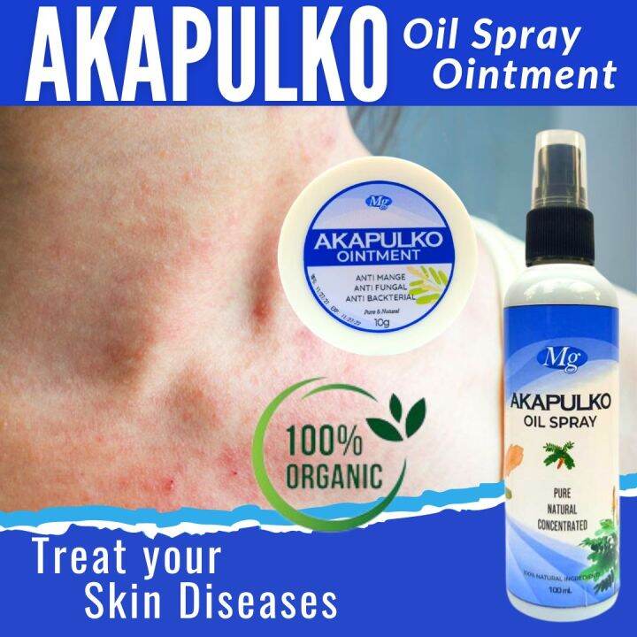 BOLD ORGANICS MG AKAPULKO SPRAY 100ML & OINTMENT 10G, ANTI ITCH ...