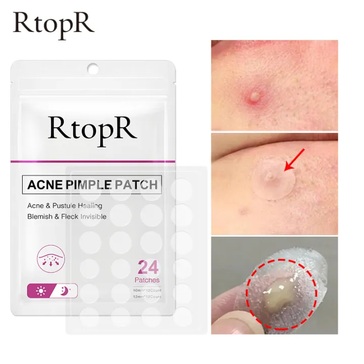 RtopR Acne Pimple Patch Acne Treatment Pimple Remover Waterproof 24 ...