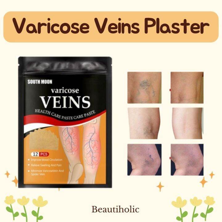 Original and Effective Pain Relief Varicose Veins Plaster Patch 12Pcs ...