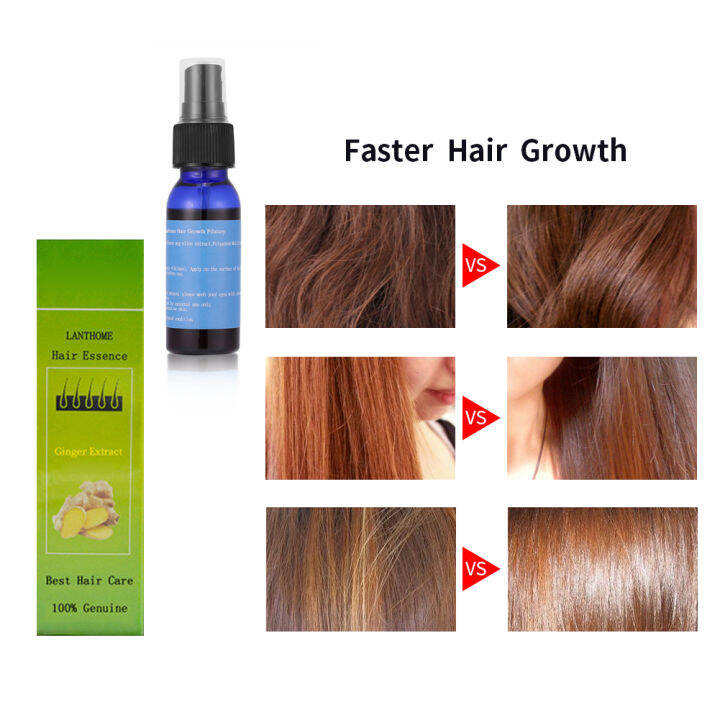 30ml Hair Growth Loss Nurishing Regrowth Essences For Women And Men