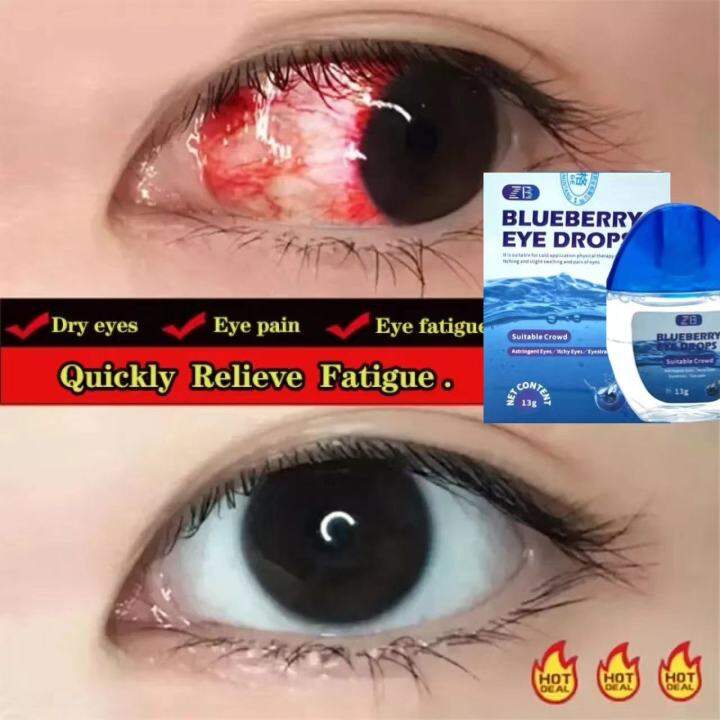 Obat tetes mata Tetes Mata Herbal Tetes Mata Alami eye drop Mengandung ...