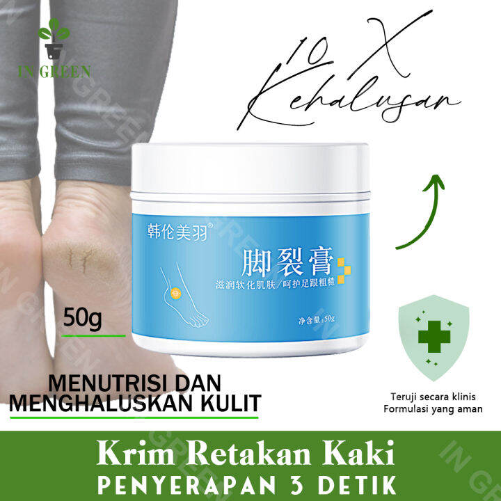 Krim Kaki Pecah-Pecah 50g Pelembab Dan Perawatan Retak Tumit Dan Cream ...