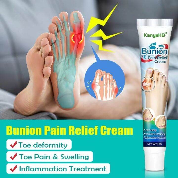 KanyeHB Arthritis Cream Bunion First Aid Medical Supplies Ointment ...