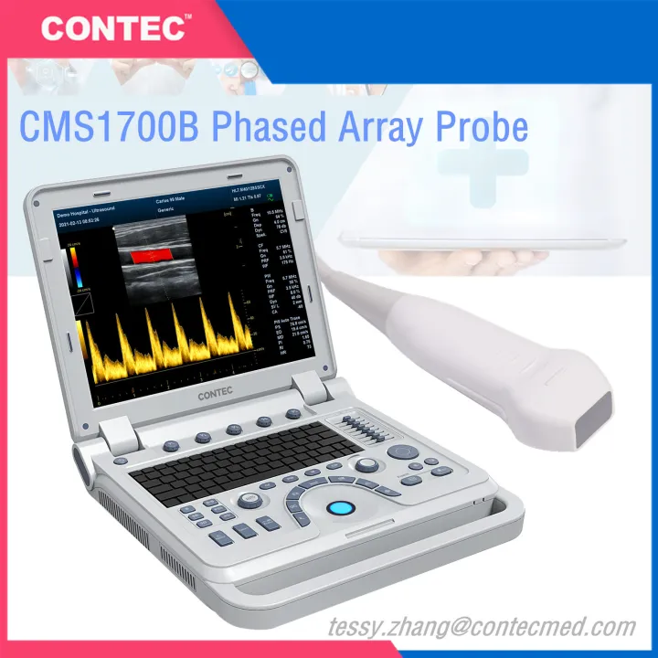 CONTEC CMS1700B Color Doppler Ultrasonic Diagnostic CF Cardiac ...