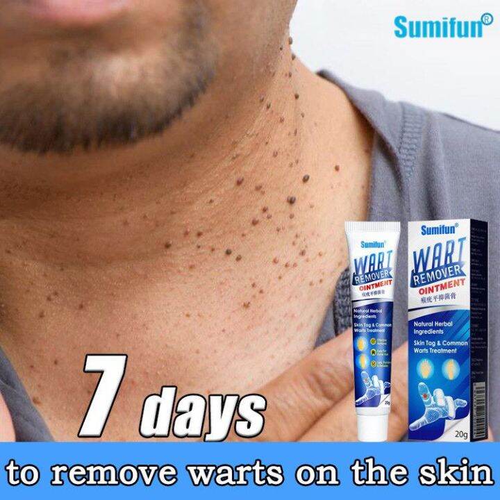 【SUMIFUN】Warts Remover Original Cream Warts Magic Remover Wart Ointment ...