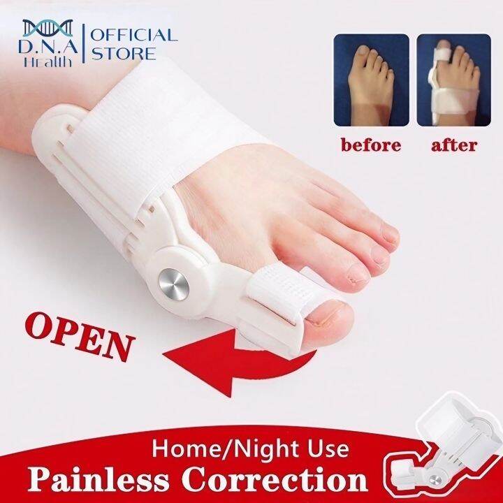 D.N.A Big Toe Corrector Toe Bunion Corrector Orthotics Feet Bone Thumb ...