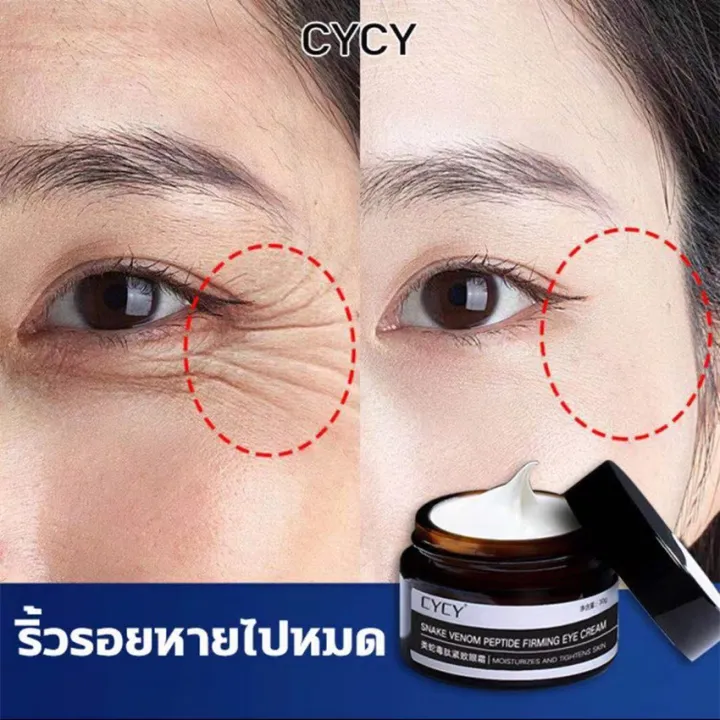 [ข้อเสนอพิเศษ]CYCYอายครีม ครีมบำรุงรอบดวงตา30gให้ความชุ่มชื่นขอบตาดำถุง ...