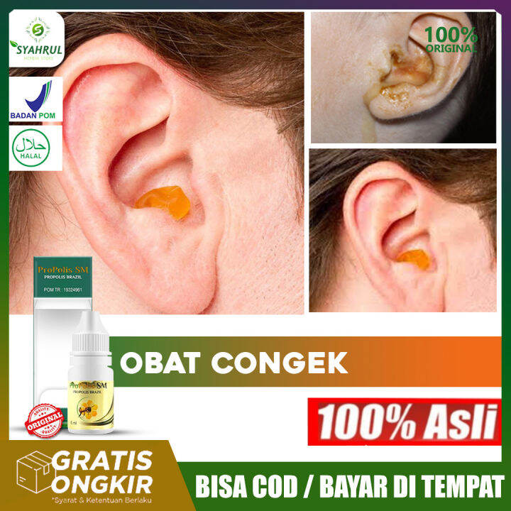 Obat Congek - Curek - Budeg - Congean - Telinga Berair - Obat Curek ...