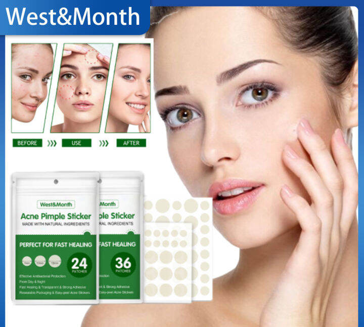 Pimple Acne Patches Hydrocolloid Acne Patch for Healing Acne Dot Skin ...