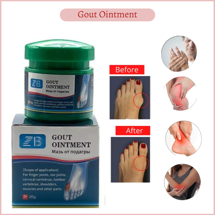 100% ORIGINAL 20g Gout Ointment Treatment Relief for Gout and Arthritis ...