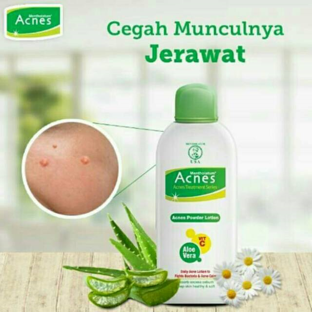 Acnes Powder Lotion - 100ml | Lazada Indonesia