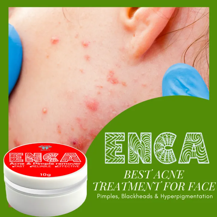 ENCA pimple and acne remover by Vivid Organic / pimple eraser / pimple ...