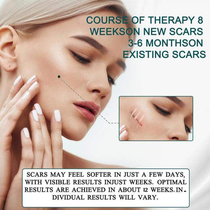 Efficient Surgery Scar Removal Silicone Gel Sheet Therapy Patch For ...