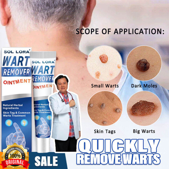 Warts Removal Original Cream Kulugo Skin Tags Mole Remover Common Warts ...