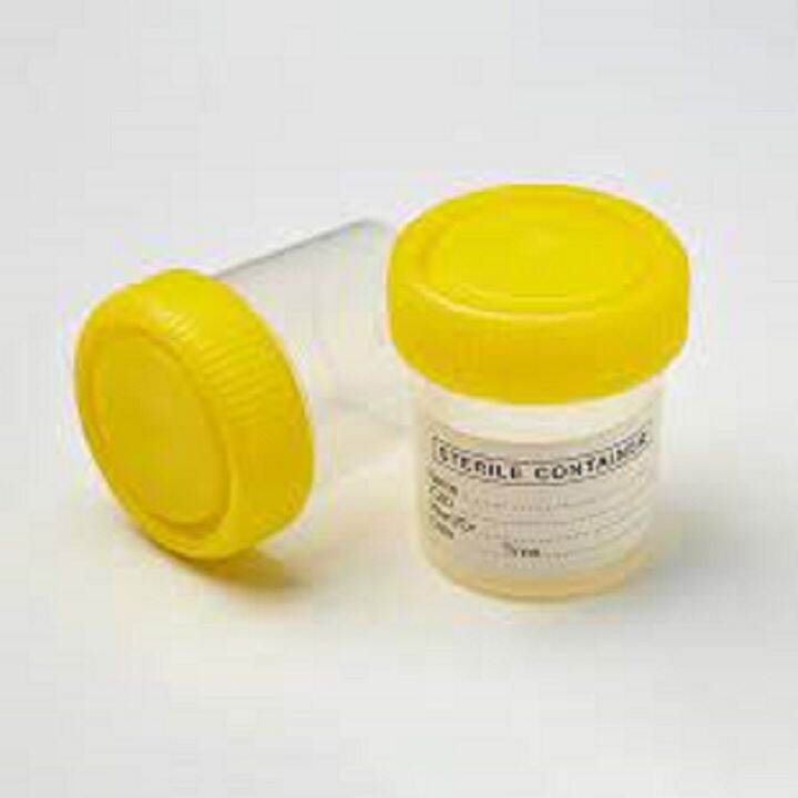 URINE CONTAINER STERILE, WITH LABEL, TALLER TYPE (60mL) | Lazada PH