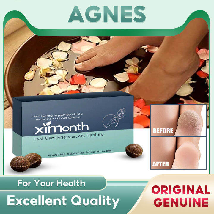 Ximonth Foot Care Effervescent Tablets For Cleaning Dead Skin On Feet ...