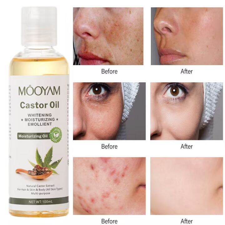 Castor Oil Moisturizers, anti-aging skin care products Whitening Body ...