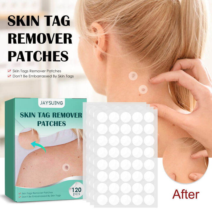 WOOLOVE 120pcs Skin Tag Remover Patch Wart Treatment Stickers Quick ...