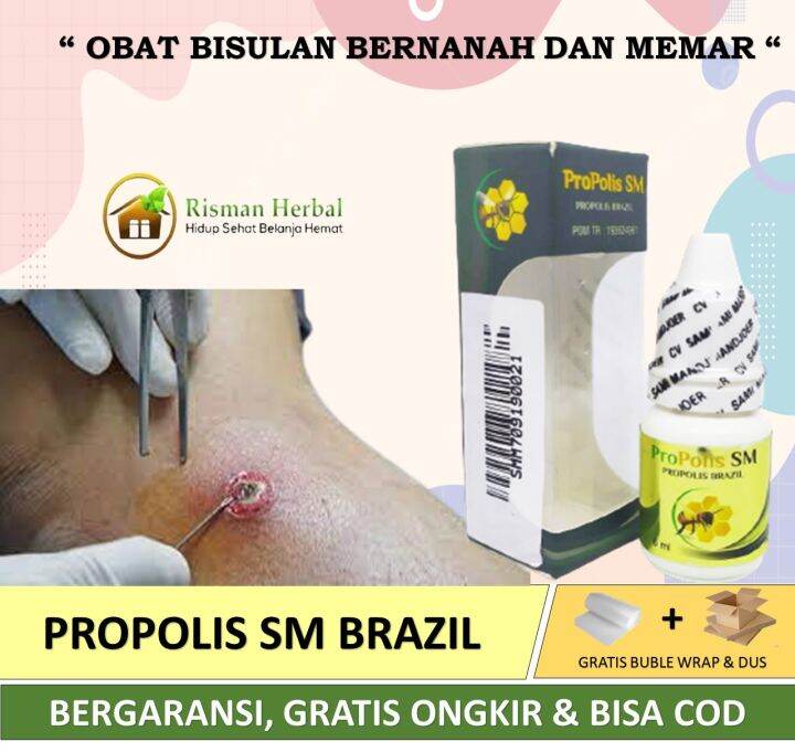 Obat Tetes Bisul Bernanah, Salep Oles Bisul Bernanah, Obat Bisul Anak ...