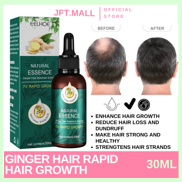 Eelhoe 30ml 1pc 7x Rapid Growth Hair Treatment Anti Hair Loss Fast Hair