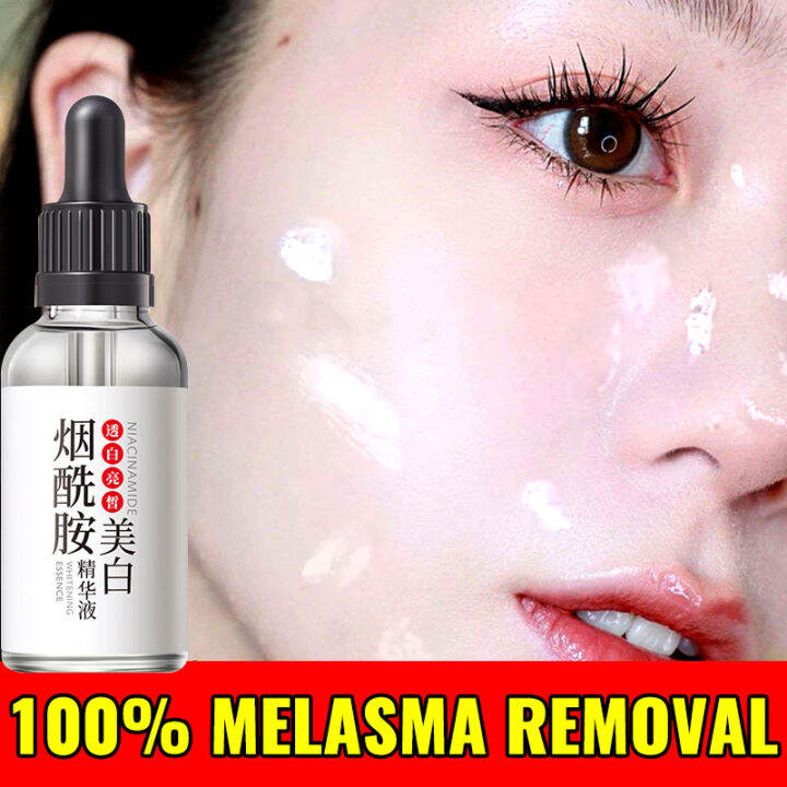 freckle serum Anti-Freckle Essence melasma and pekas remover serum ...