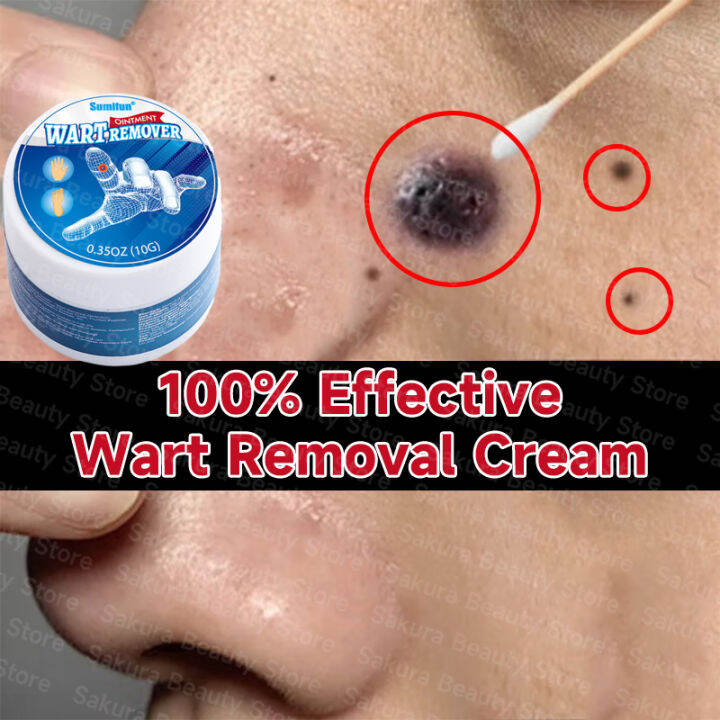 Authentic Sumifun Cream Warts Remover Very Effective And Safe Treatment ...